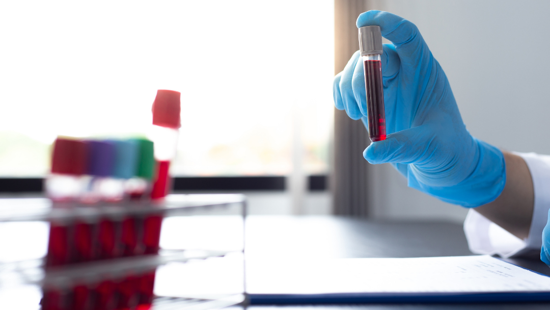 Back to the Basics: Blood Disorders - Limmer Education