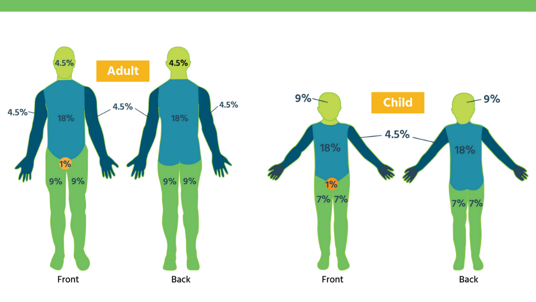 Mastering Burn Formulas - Limmer Education