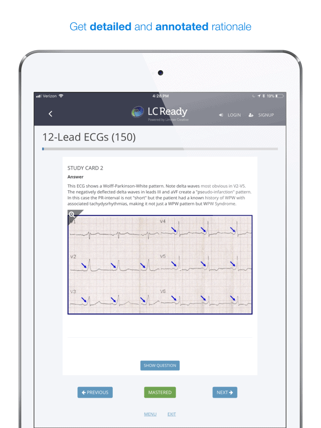 12-Lead ECG Challenge – Limmer Education, LLC